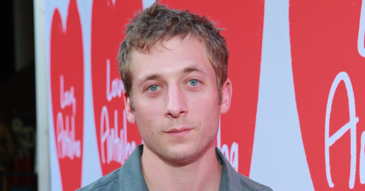 'Shameless' Star Jeremy Allen White's New Comedy Officially a Go ...