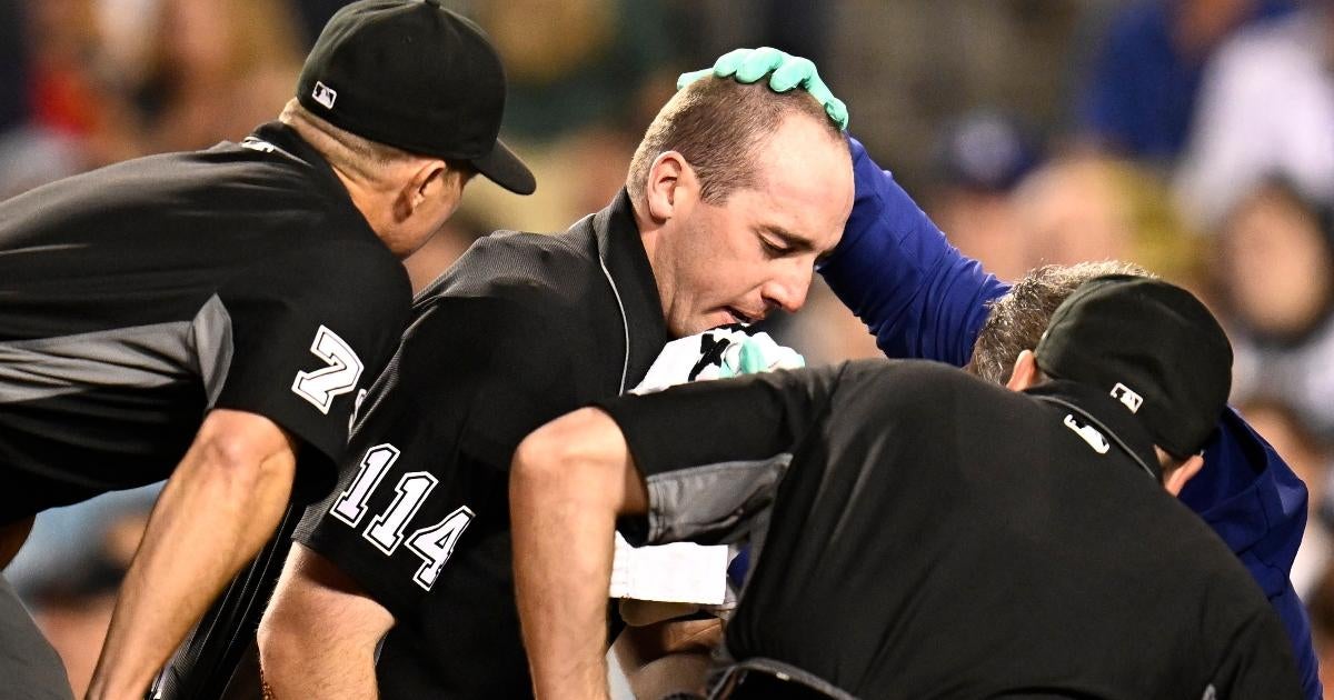 MLB Umpire Nearly Loses His Eye in Shattered Bat Accident - PopCulture.com