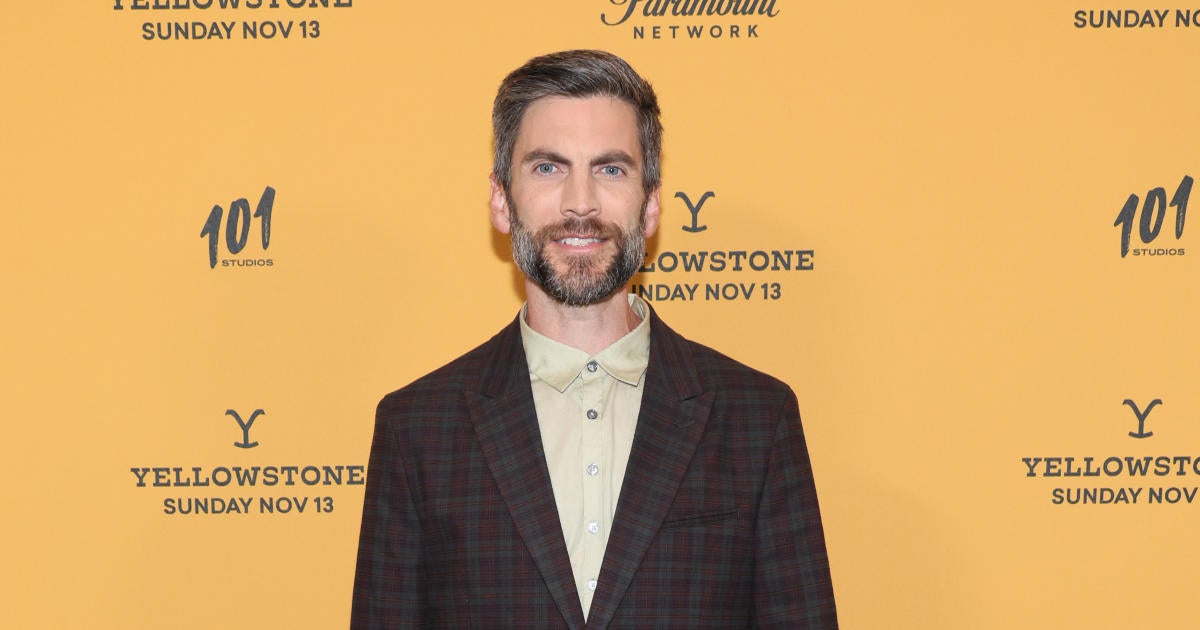 'Yellowstone': Jamie Dutton Actor Wes Bentley Reveals Painful Injury ...