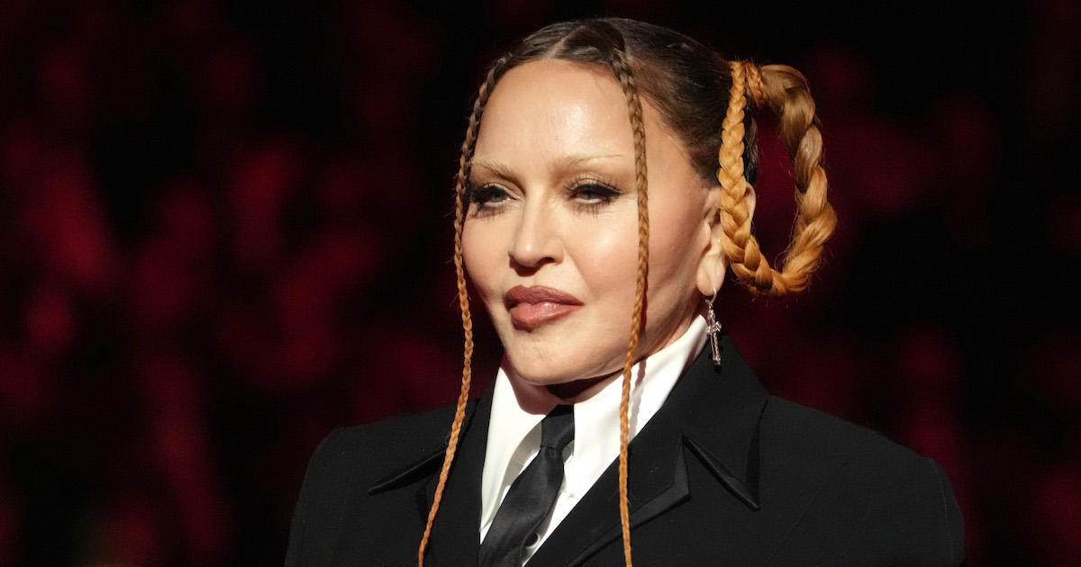 Madonna Shares New Photo of Her Face, Says Surgery Swelling Has Gone ...