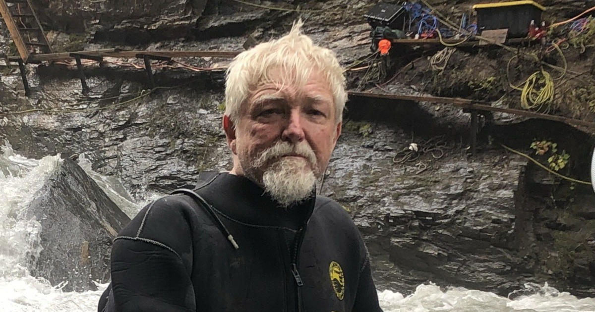 'Gold Rush' Personality 'Dakota' Fred Hurt Reveals Brain Cancer ...