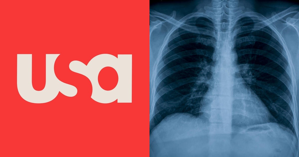 USA Network Star Cracks Multiple Ribs: What to Know About Josh Briggs ...