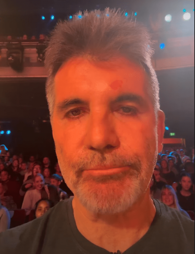 Simon Cowell Suffers Head Injury - PopCulture.com